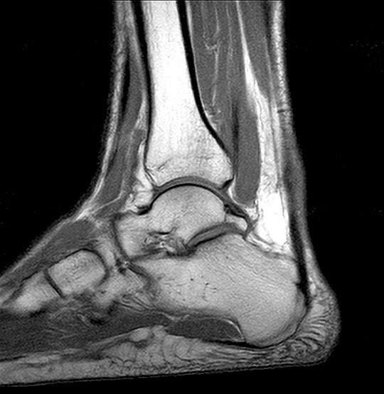Ankle MRI scan | Medserena Open MRI