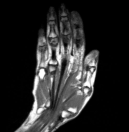 Hand MRI scan | Medserena Open MRI